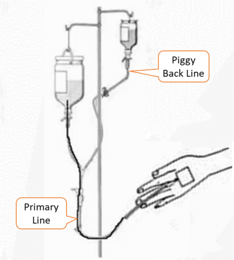 The Intake-Output Chart | HEALTHCARE SERVICE DELIVERY